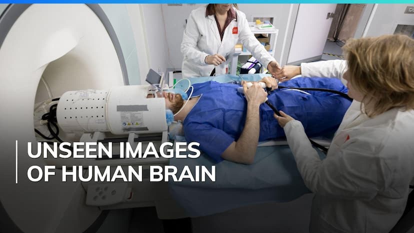 World‘s most powerful MRI scans first images of human brain | Watch ...